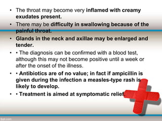 Sore throat, diagnosis and management for Pharmacist | PPTX