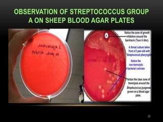 Sore throat and streptococcal pharyngitis | PPTX