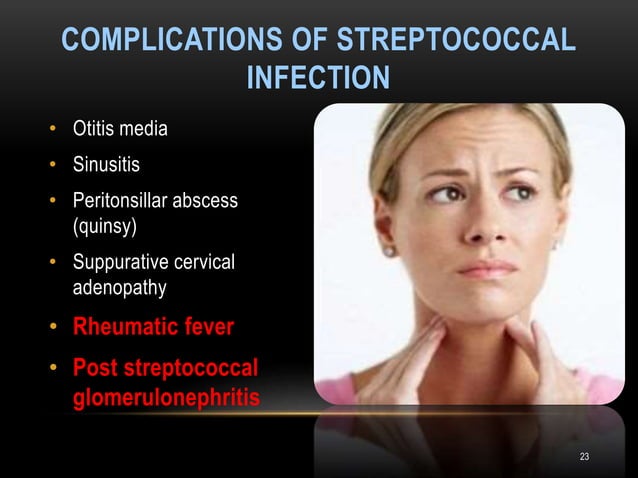 Sore throat and streptococcal pharyngitis
