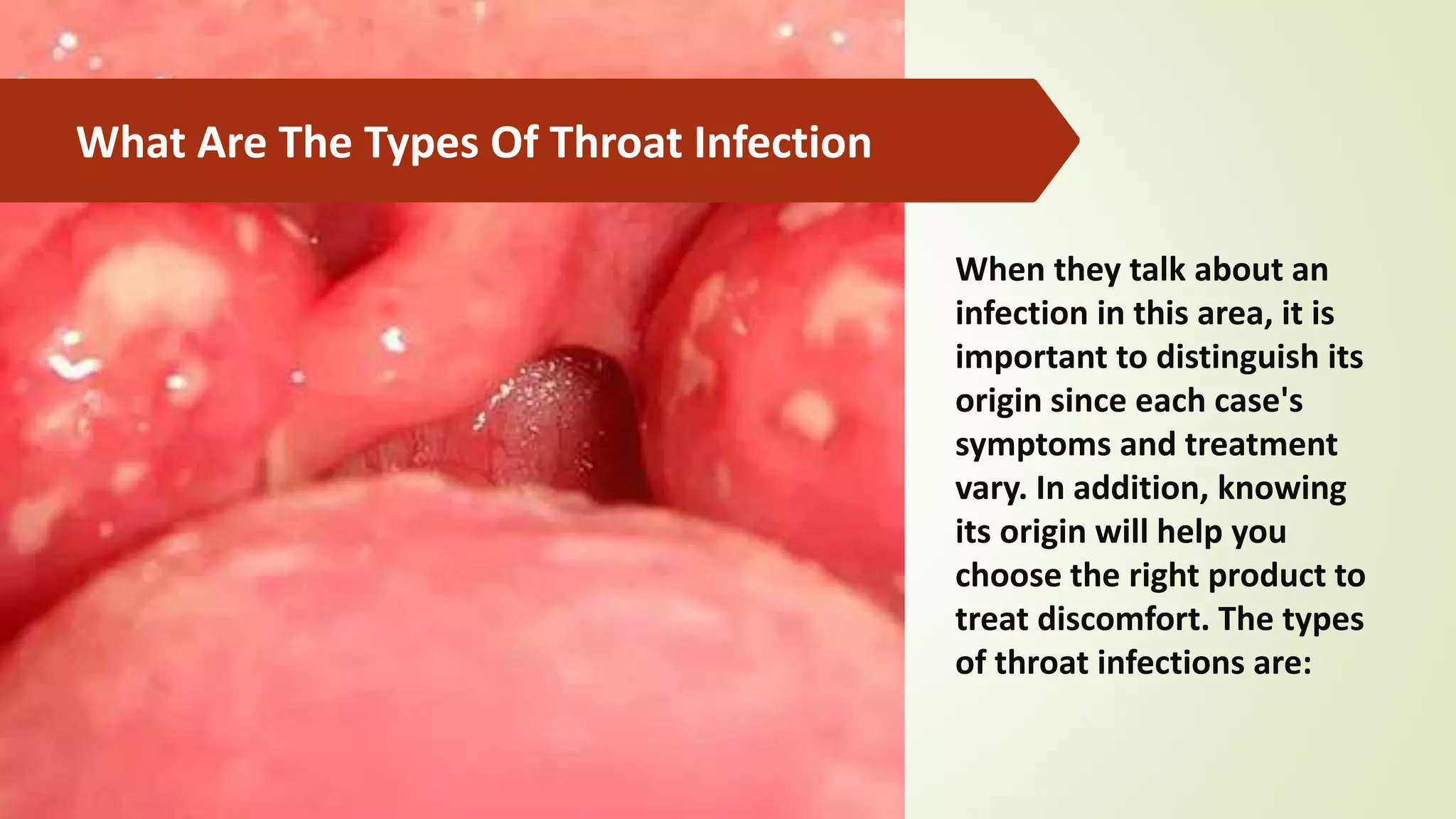 Sore Throat Treatment.pptx