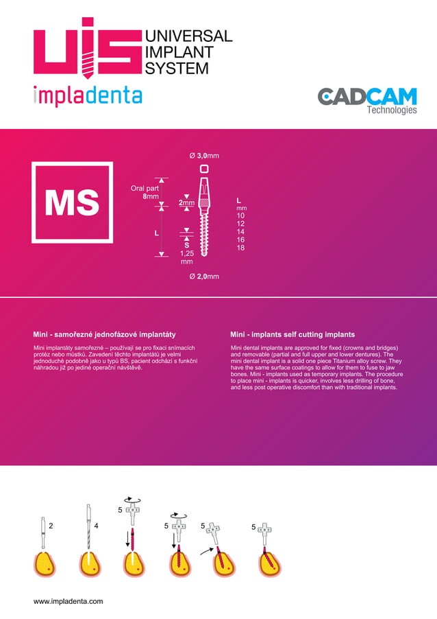 IMPLADENTA - Universal Implants System | PDF