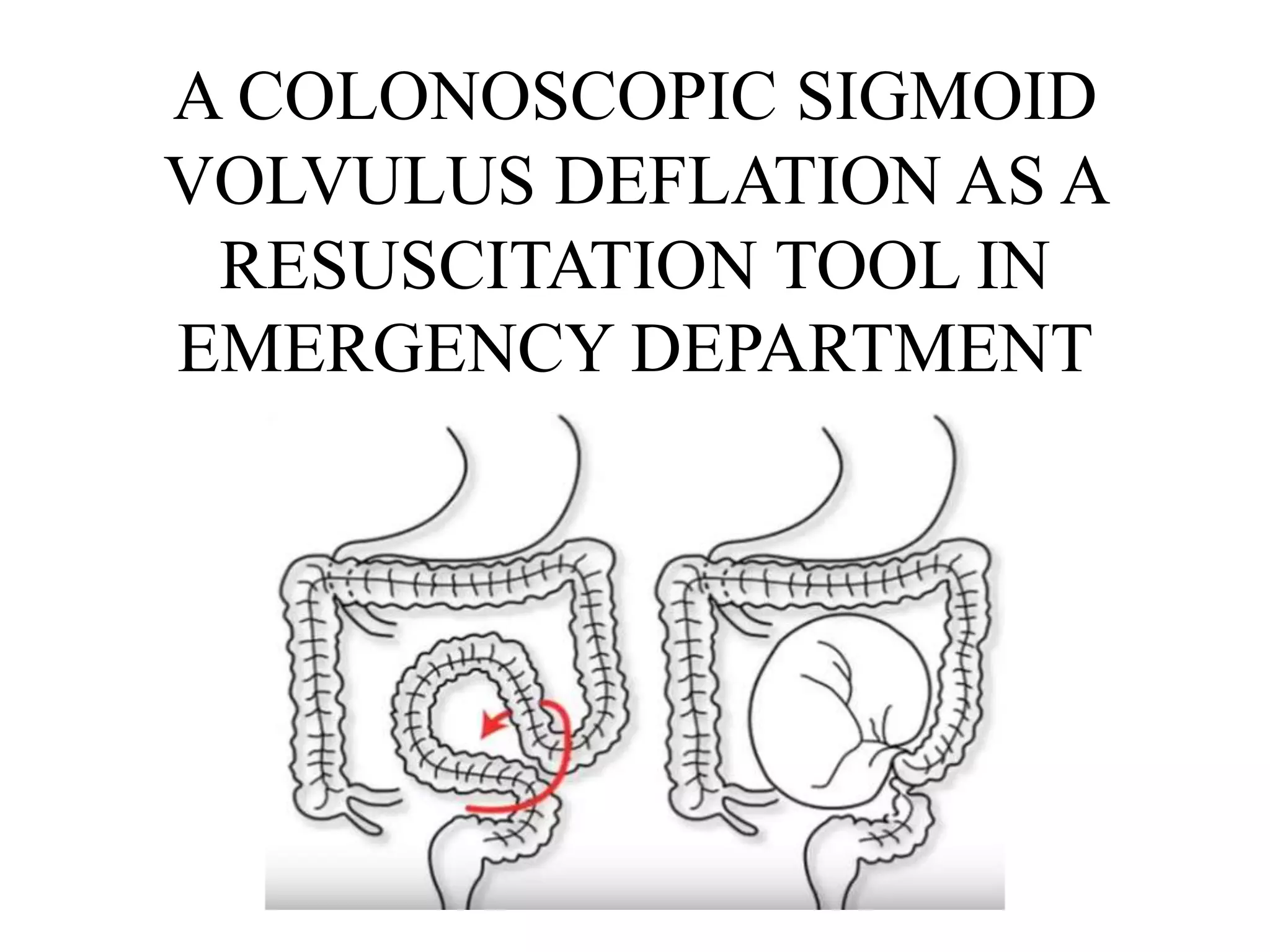 COLONOSCOPIC VOLVULUS DEFLATION | PPT