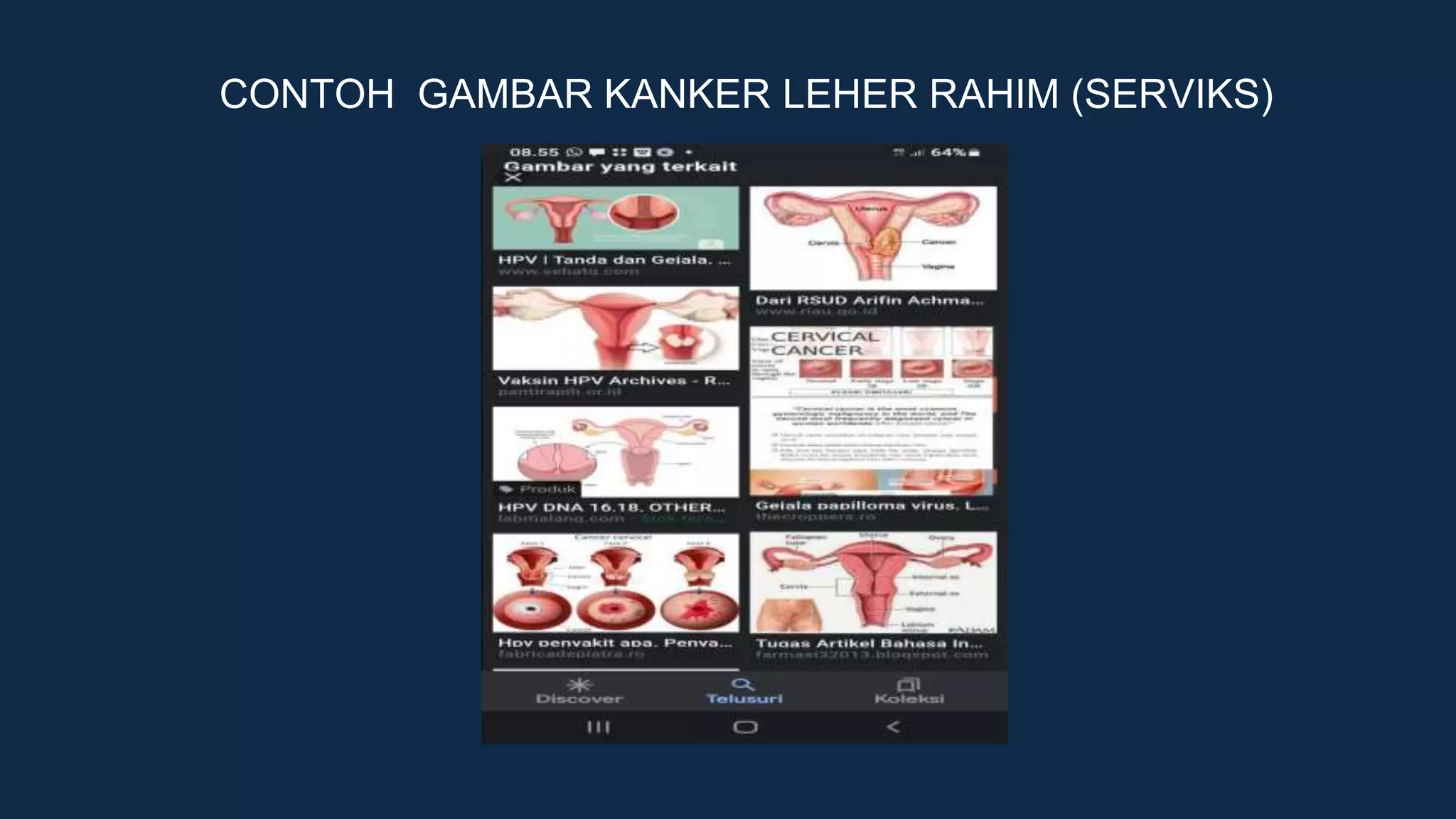 Sosialisasi HPV di sekolah.pptx