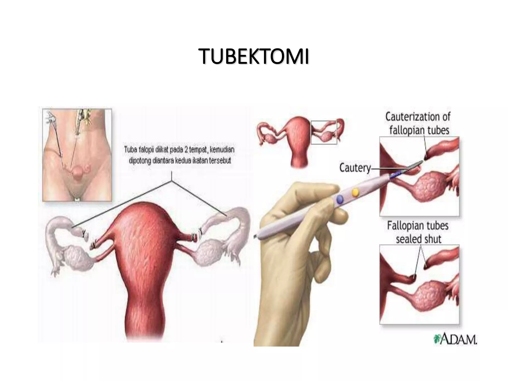 SOSIALISASI KB DENGAN MKJP.pptx