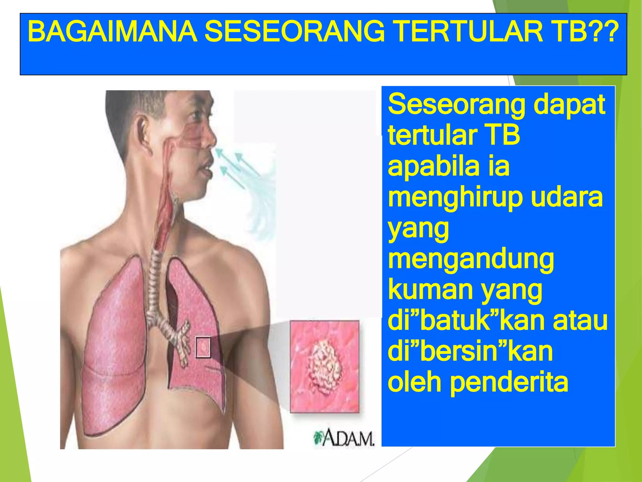 Penyuluhan Penyakit Menular Penyakit TB PARU Di Sekolah | PPT