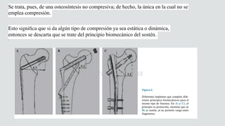 sosten biomecanica principio de ortopedia, | PDF