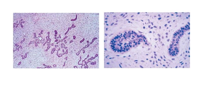 1. Ameloblastic fibroma 2. Odontoma 3. Squamous odontogenic tumor | PPTX