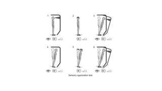 Sensory organization test (CTSIB) for balance | PPT