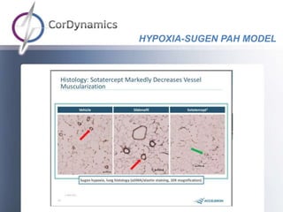 Sotatercept for Hypoxia Sugen PAH at CorDynamics | PPTX