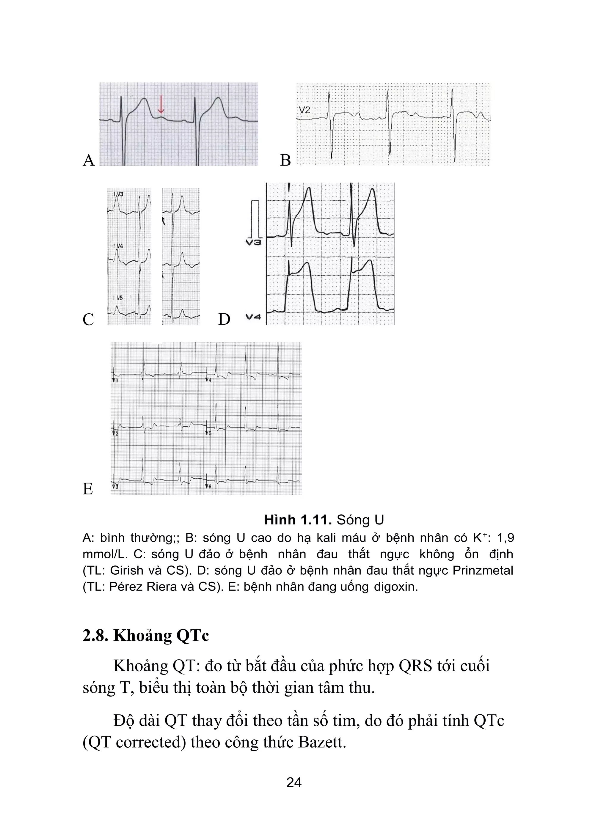 Sổ tay điện tâm đồ - Phạm Nguyễn Vinh | PDF