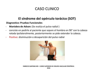 SINDROME DEL OPERCULO TORACICO MD SANTANA MENDOZA FABRICIO 2018 | PPTX