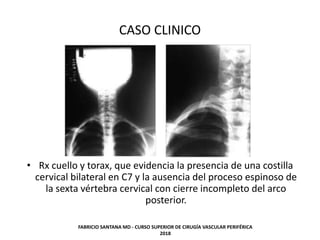 SINDROME DEL OPERCULO TORACICO MD SANTANA MENDOZA FABRICIO 2018 | PPTX