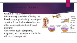 Soumya Ray - Giant Cell Arthritis Analysis | PPT