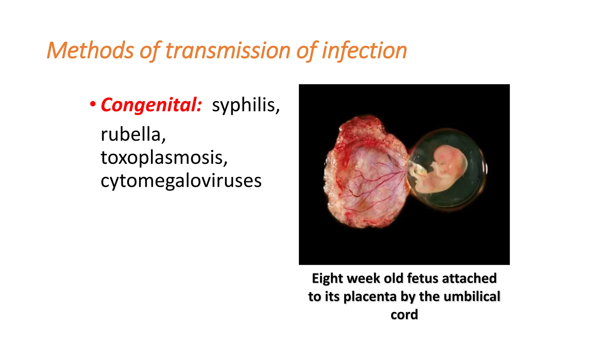 Sources of infection & types by Dr. Prince C P | PPTX