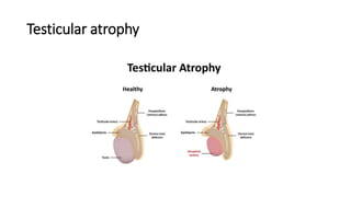 Southern SARMs (Selective Androgen Receptor Modulators) - Ways to ...
