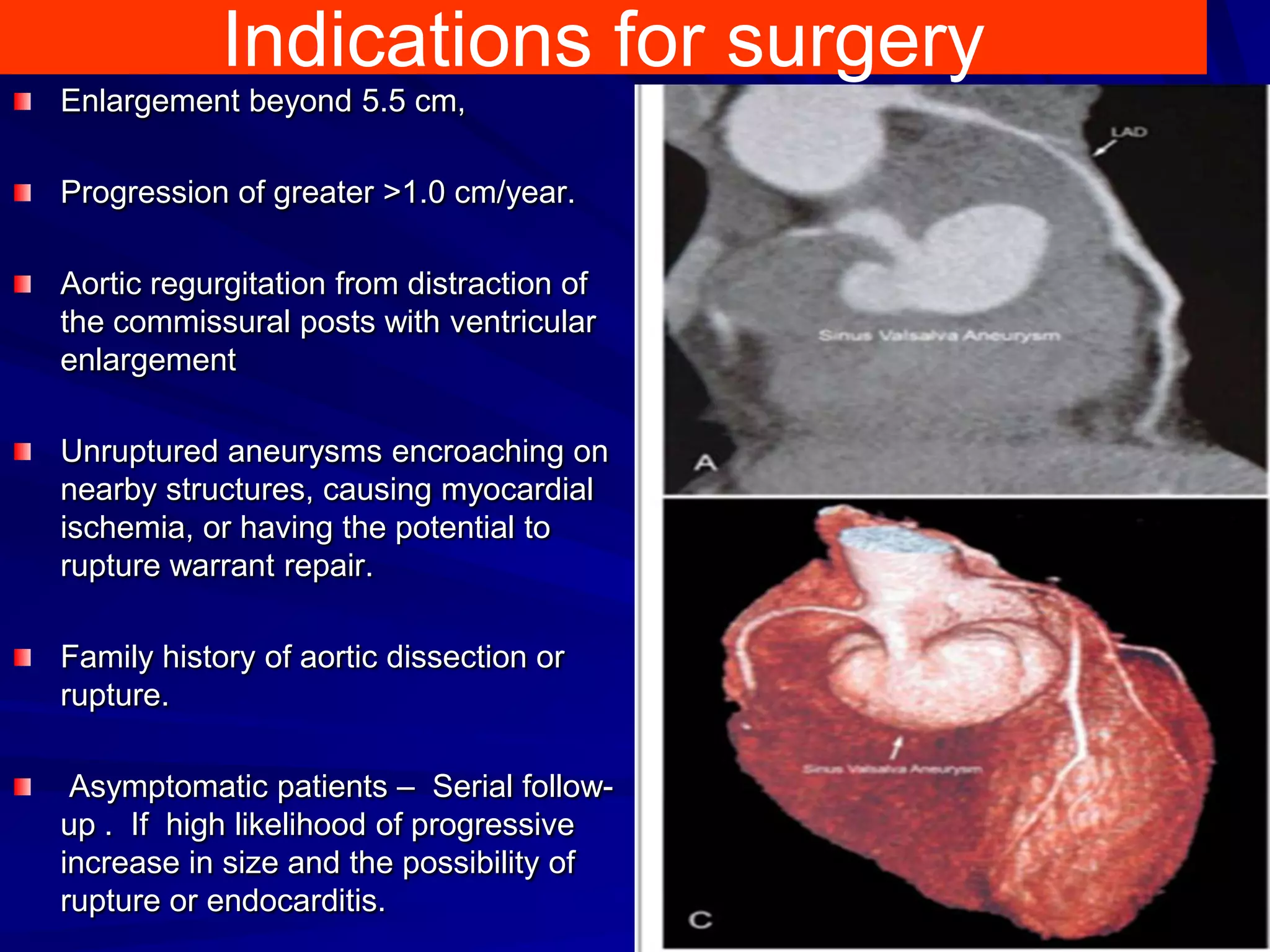 SINUS OF VALSALVA ANEURYSM | PPT