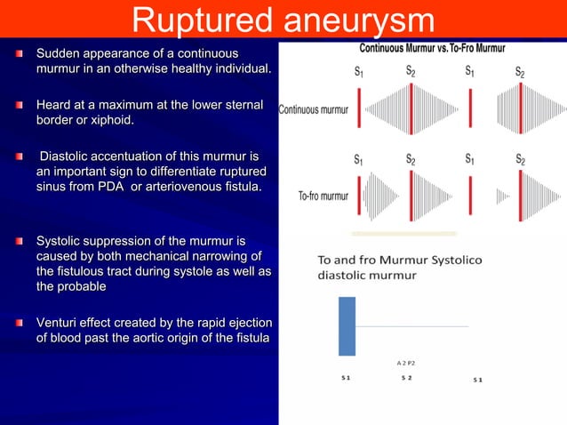 SINUS OF VALSALVA ANEURYSM | PPTX | Heart and Cardiovascular Diseases ...