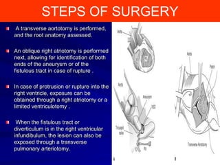SINUS OF VALSALVA ANEURYSM | PPTX