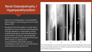 study of weekend Bone Metabolic Disease.pptx