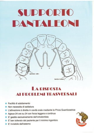 Supporto Pantaleoni | PDF