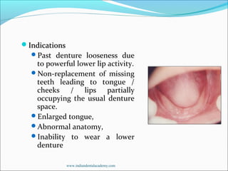 Sp.imp.procedures./ orthodontic assistant training | PPT | Oral care ...