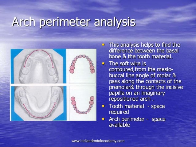 Space analysis /certified fixed orthodontic courses by Indian dental