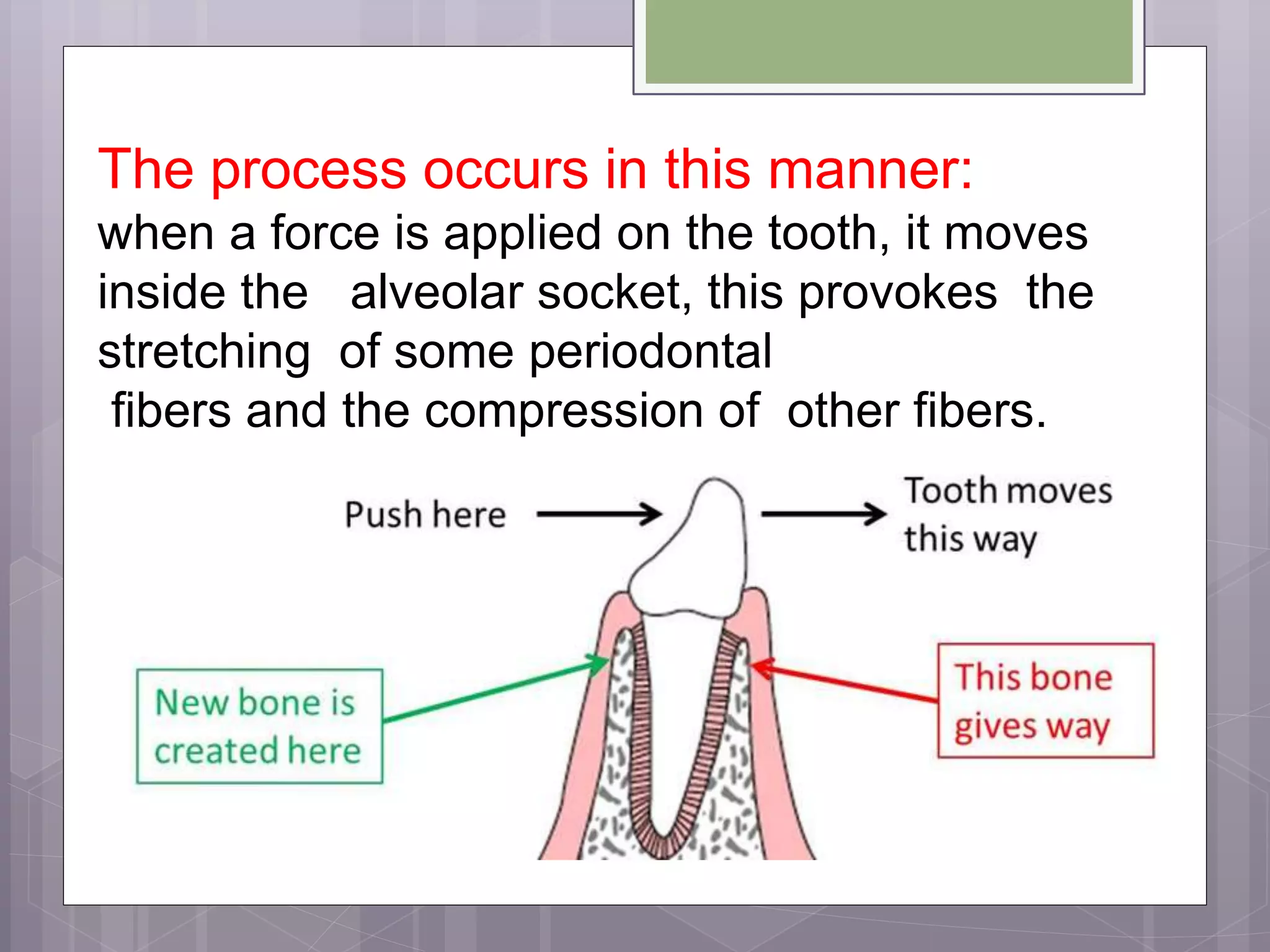 Space closure in orthdontics | PPTX