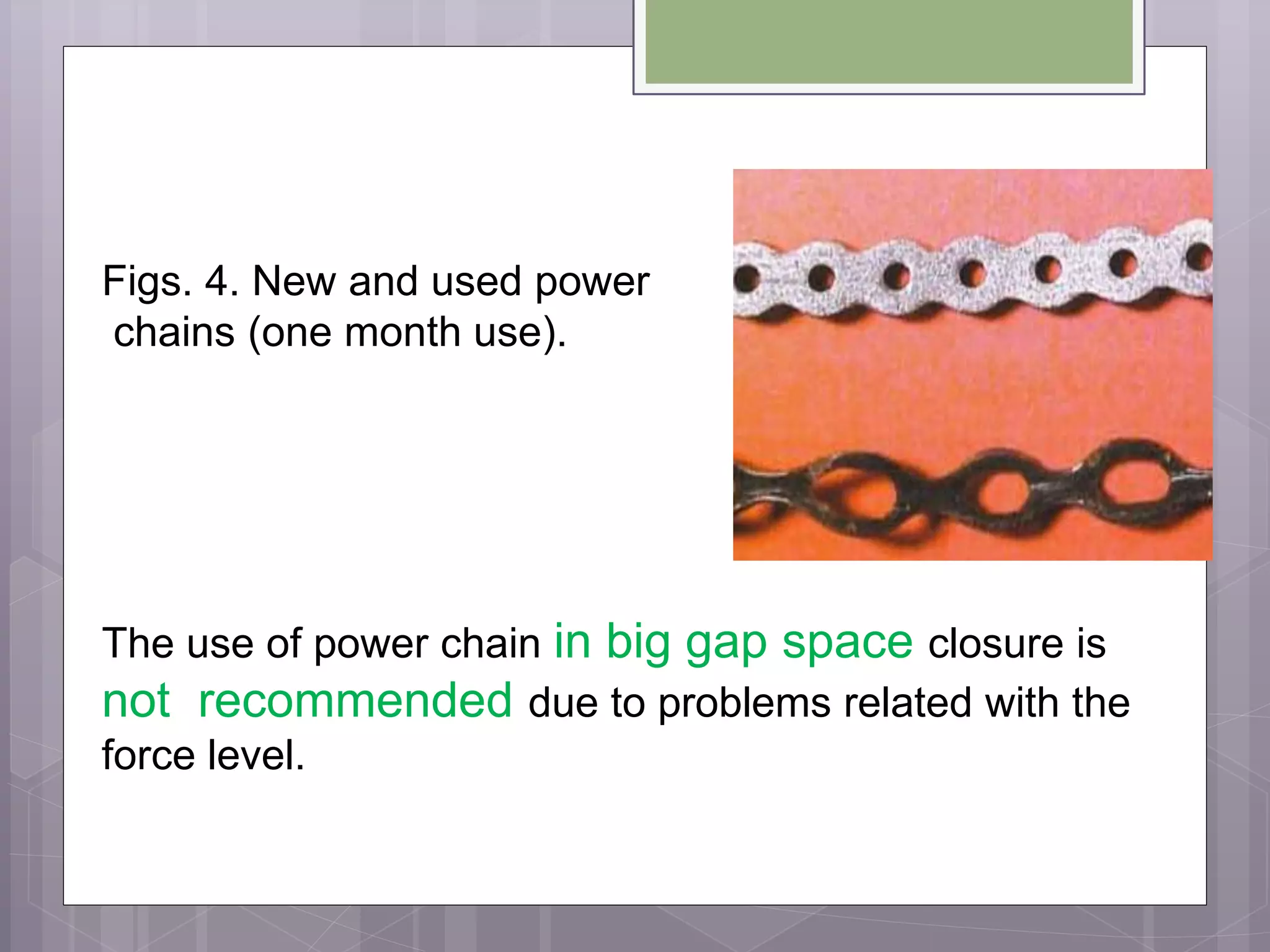 Space closure in orthdontics | PPTX