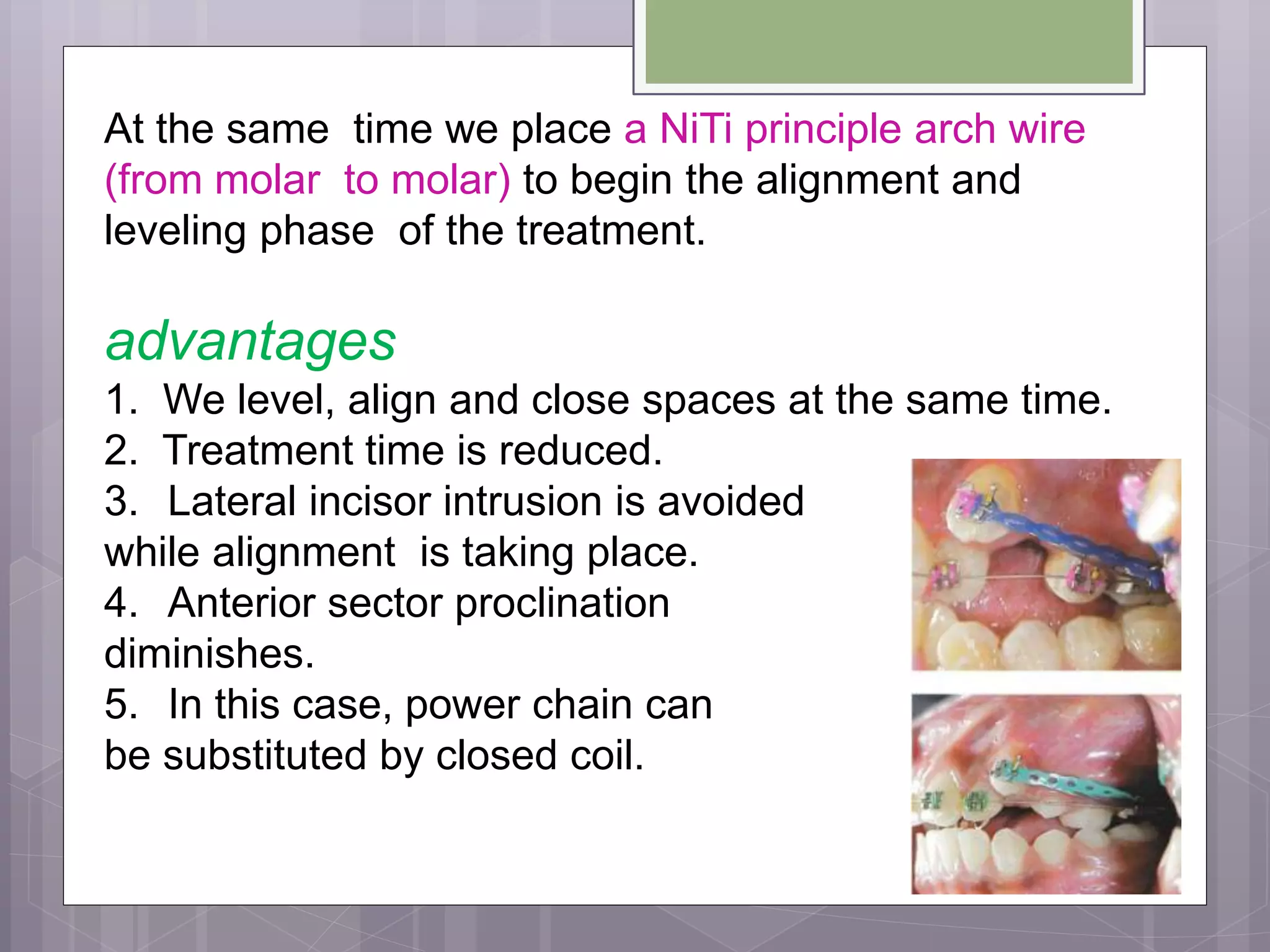 Space closure in orthdontics | PPTX