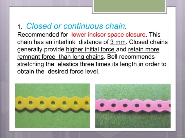 Space closure in orthdontics | PPTX