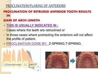 Space Gaining Method Akash Kar, | PPTX | Oral care | Personal Care