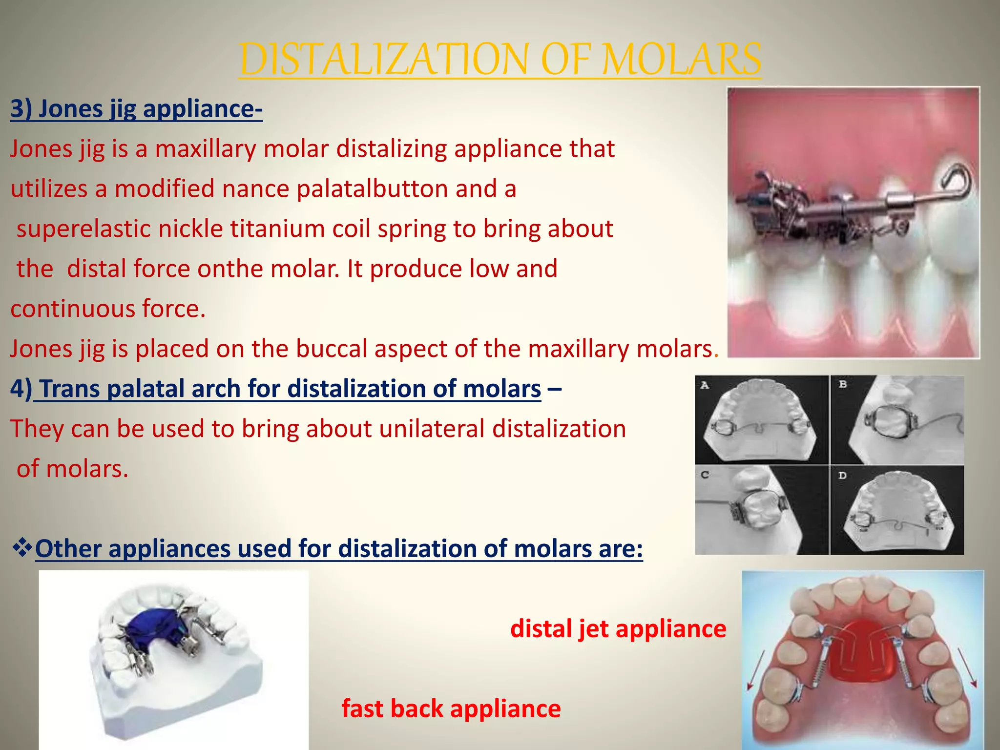 Space gaining methods -ORTHODONTICS | PPTX