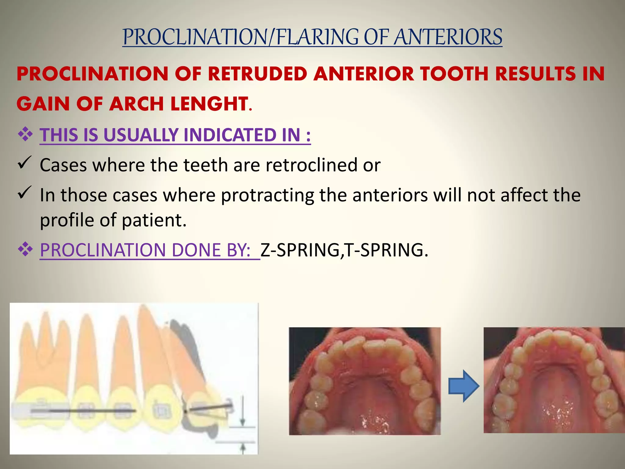 Space gaining methods -ORTHODONTICS | PPTX