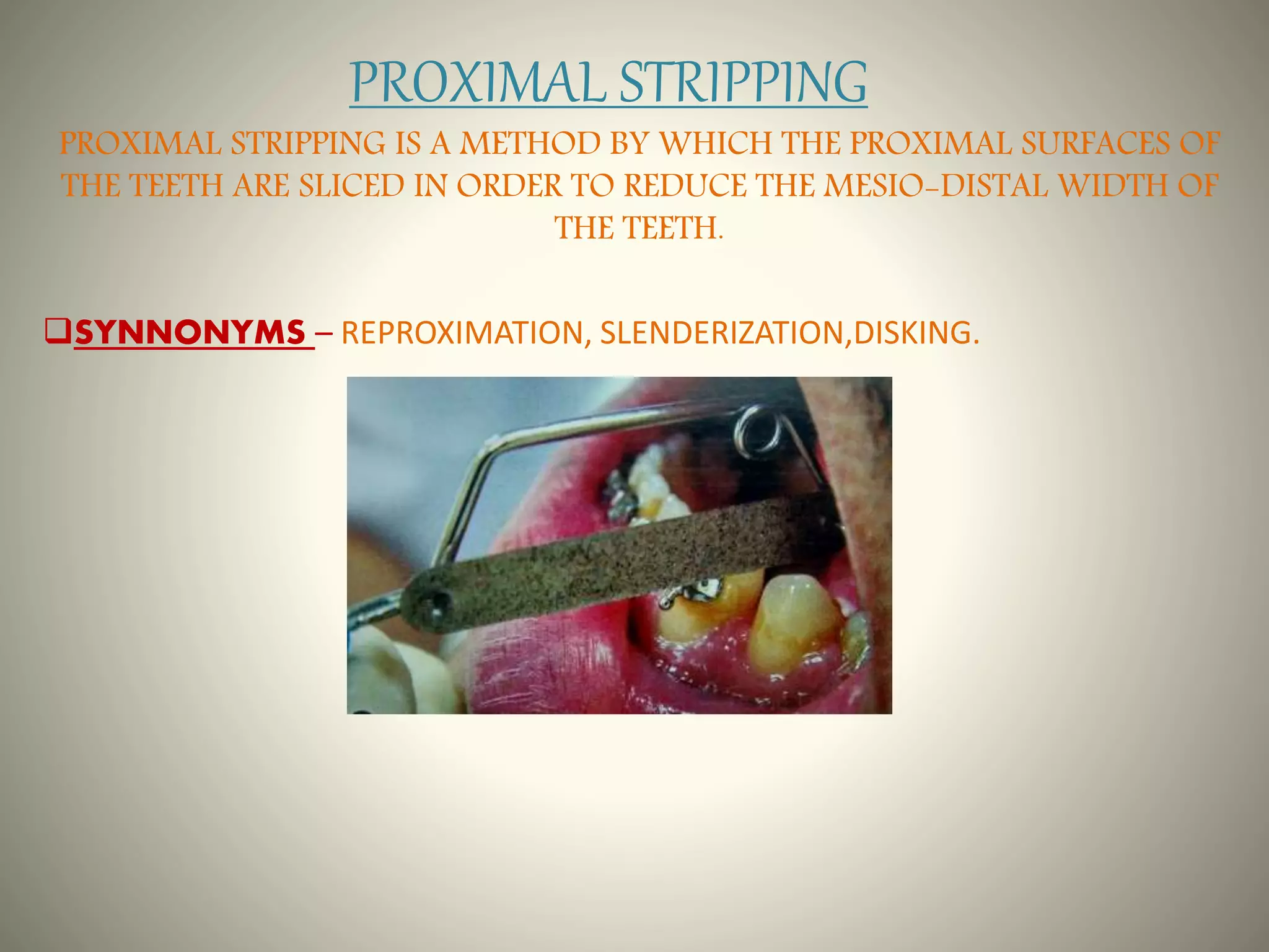 Space gaining methods -ORTHODONTICS | PPTX