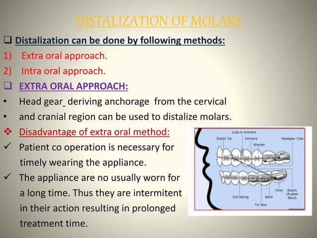 Space gaining methods -ORTHODONTICS | PPTX | Dental Health | Diseases and Conditions