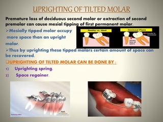 Space gaining methods -ORTHODONTICS | PPTX