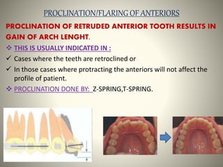 Space gaining methods -ORTHODONTICS | PPTX