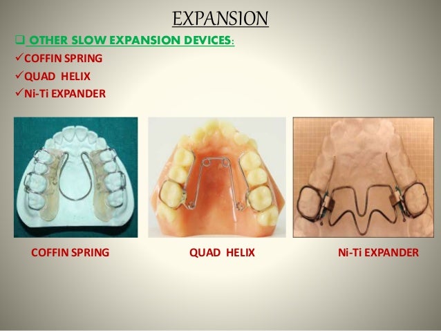 Space gaining methods -ORTHODONTICS