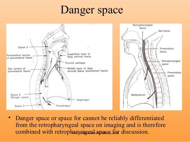 Space infection 2 /certified fixed orthodontic courses by Indian dent…
