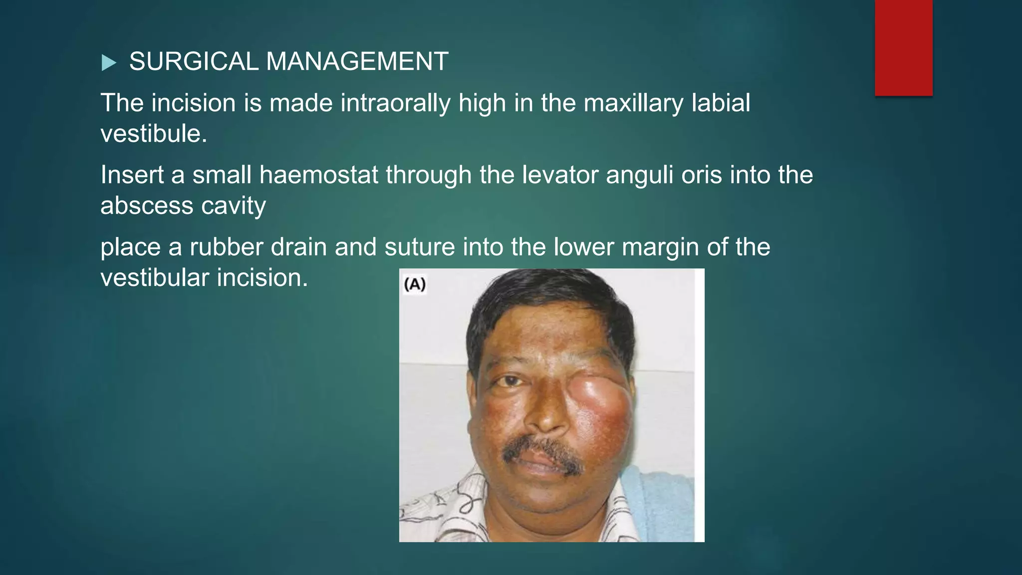 space infection.pptx