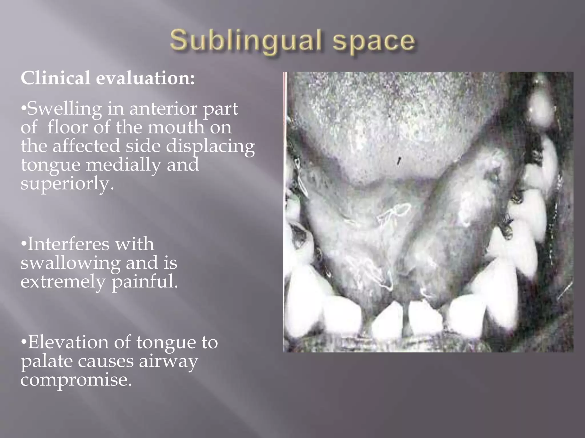 Space-infection ih | PPTX