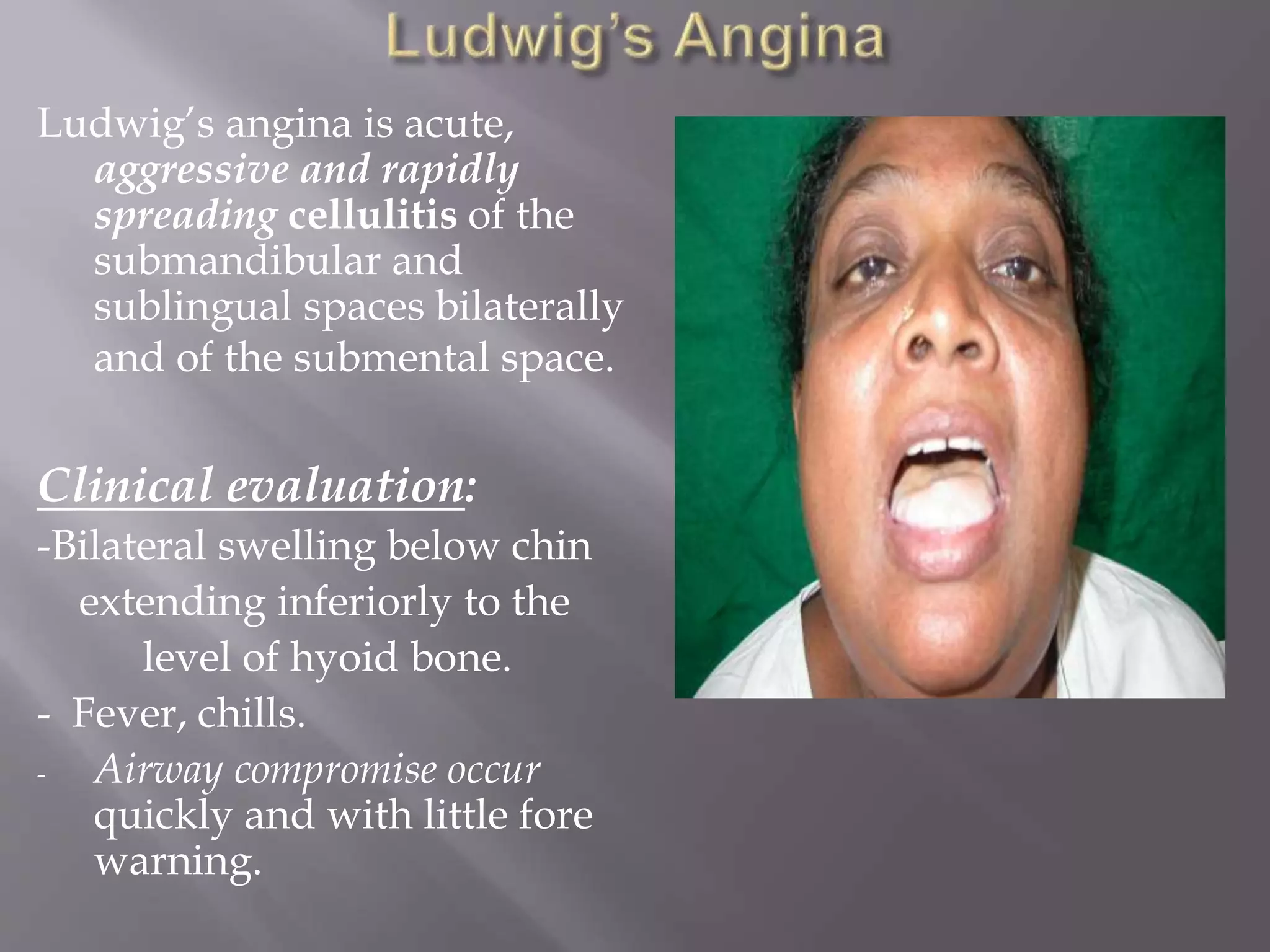 Space-infection ih | PPTX