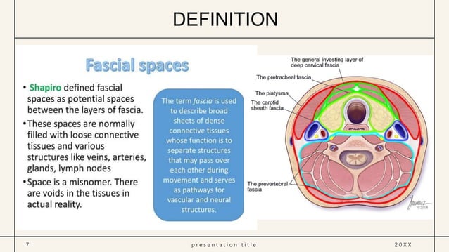 Fascial SPACE INFECTION | PPTX