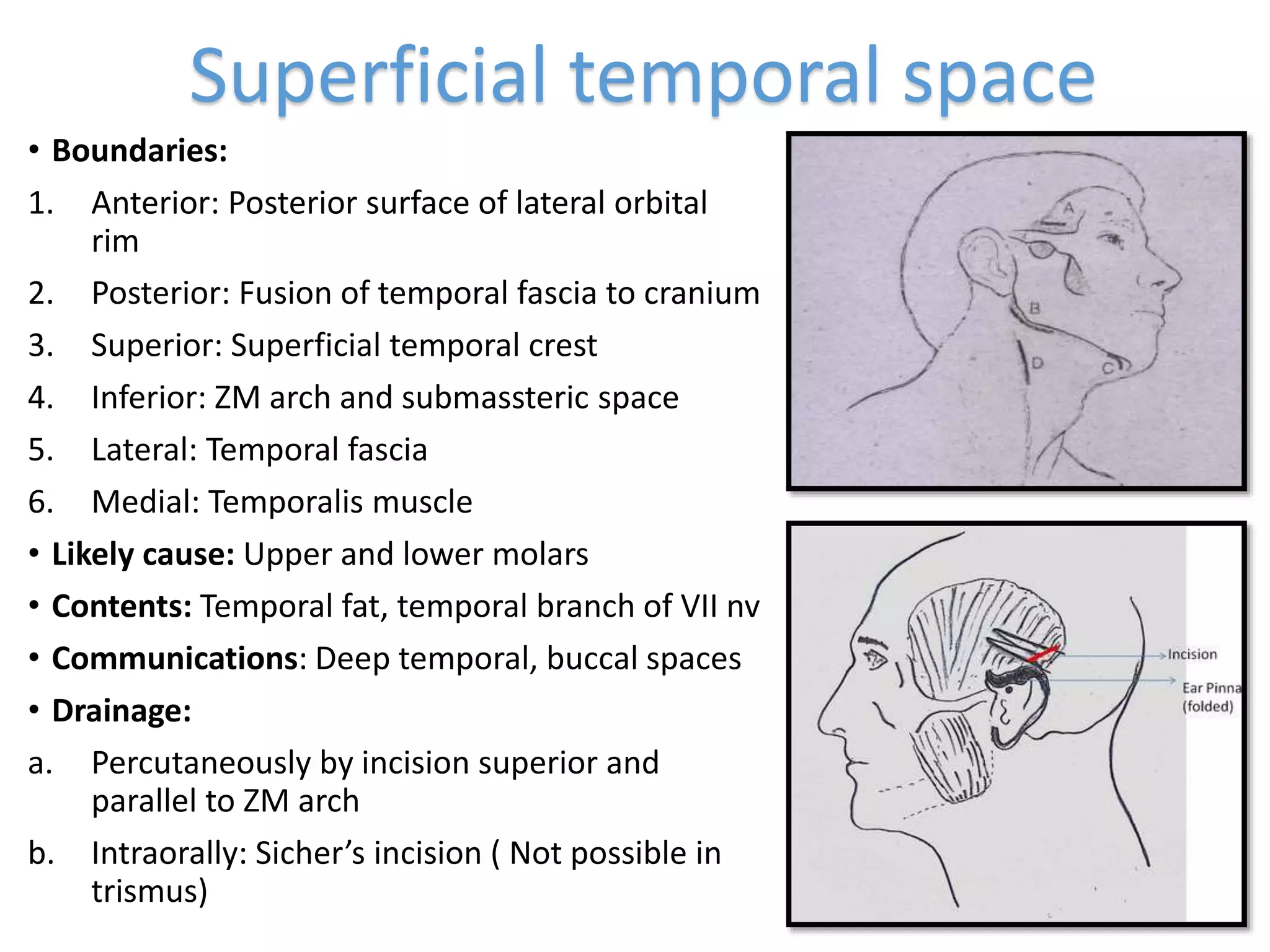 Maxillofacial space infections | PPTX