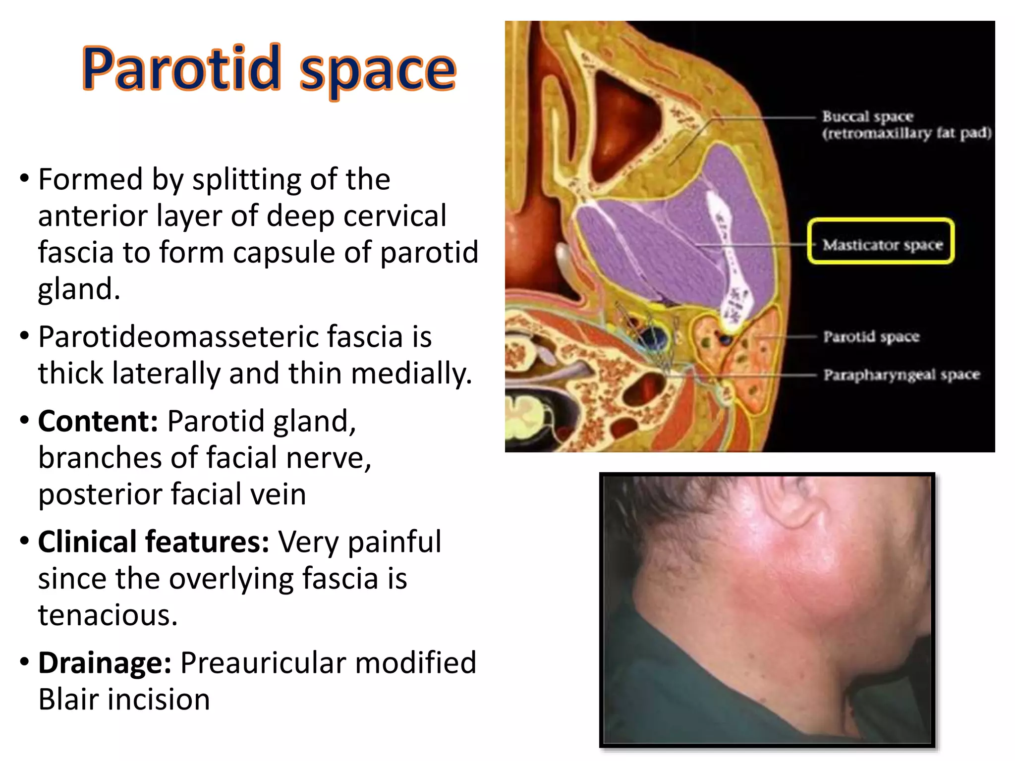 Maxillofacial space infections | PPTX