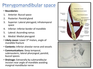 Pterygomandibular Space Infection