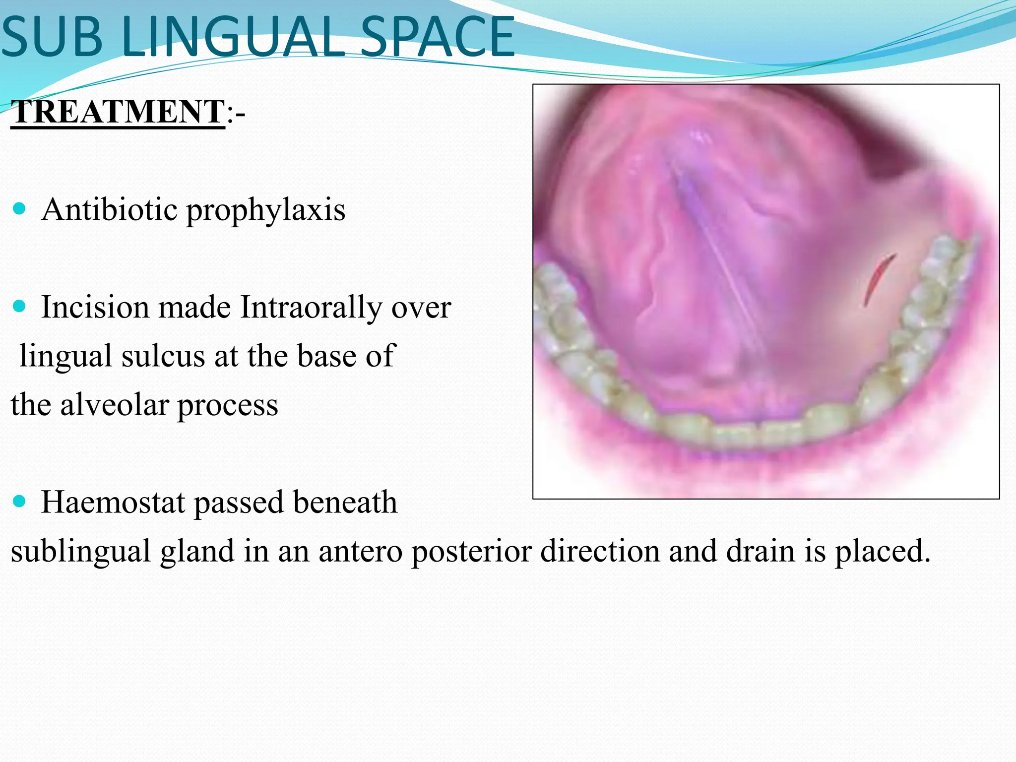 SPACE INFECTIONS-TYPES, DIAGNSOSIS AND MANAGEMENT | PPTX