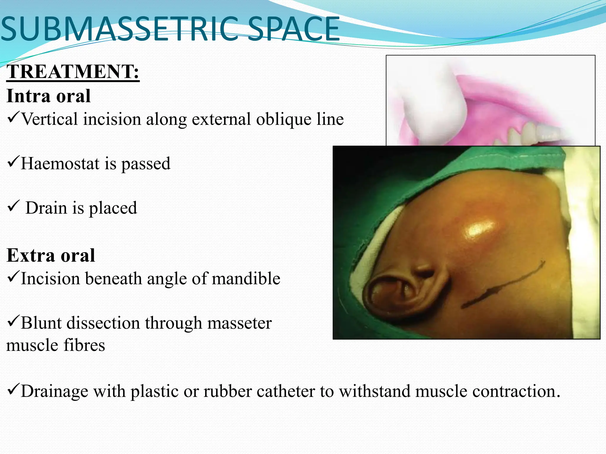 SPACE INFECTIONS-TYPES, DIAGNSOSIS AND MANAGEMENT | PPTX