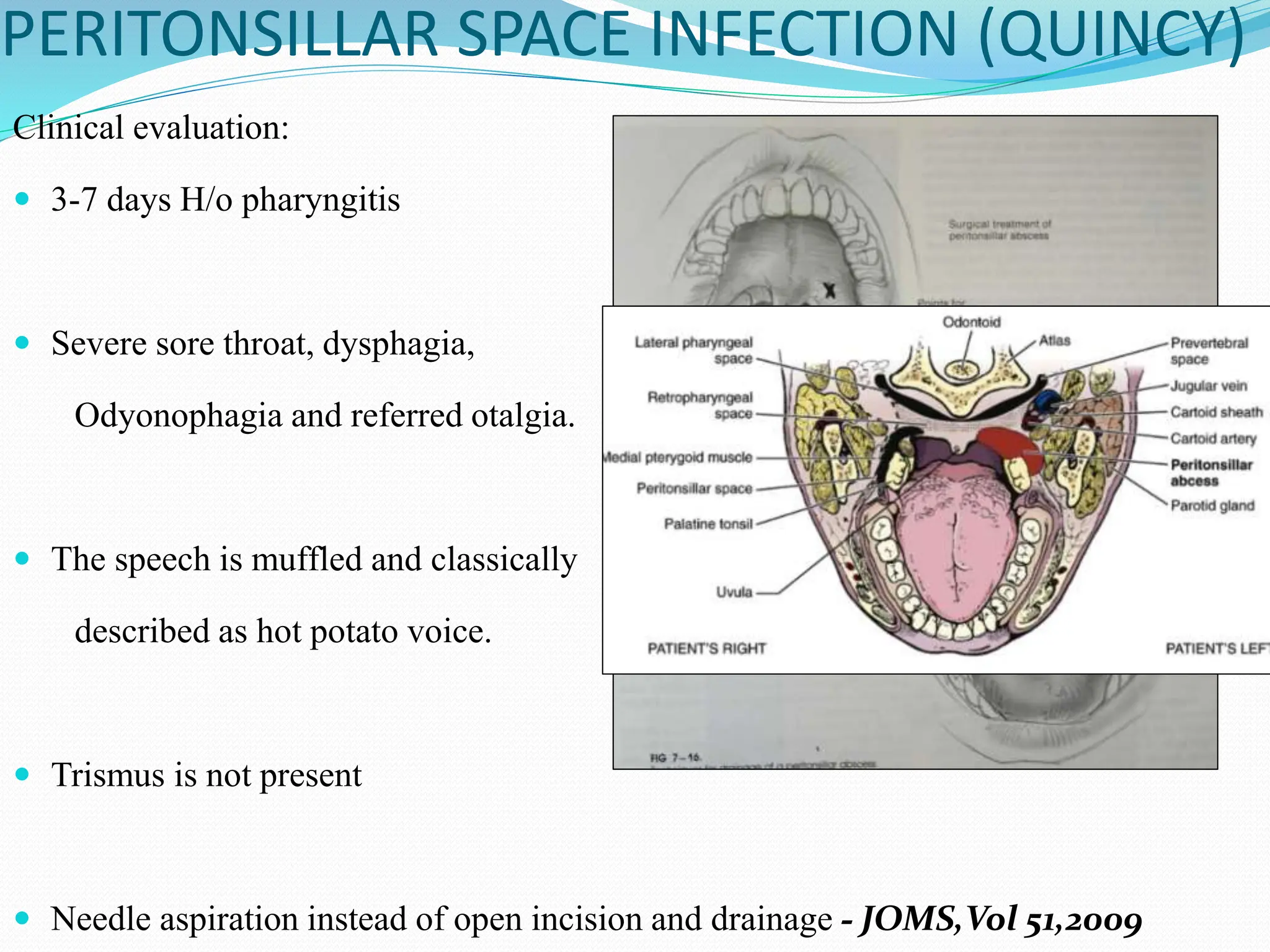 SPACE INFECTIONS-TYPES, DIAGNSOSIS AND MANAGEMENT | PPTX