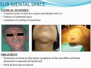 SPACE INFECTIONS-TYPES, DIAGNSOSIS AND MANAGEMENT | PPTX